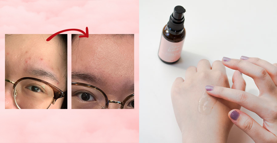 Oh Hello Bae Aloha Skin Enzyme Resurfacing Serum reviews: 15 readers ...