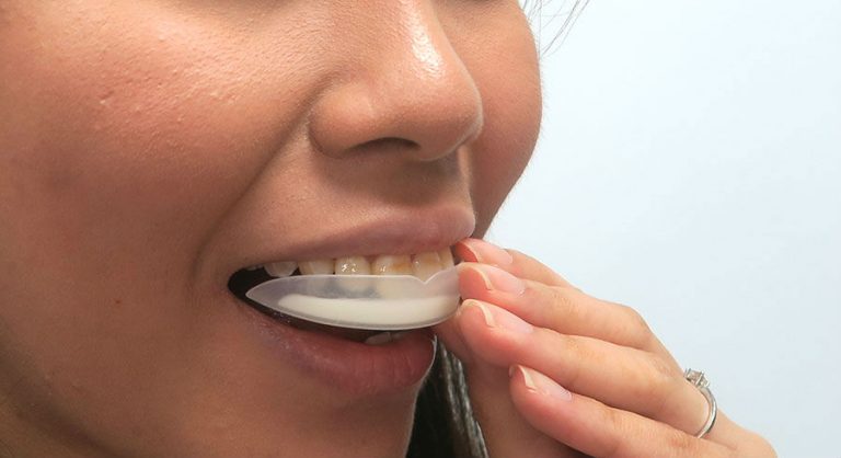 iWhite Instant Teeth Whitening Kit review: See before and after photos!