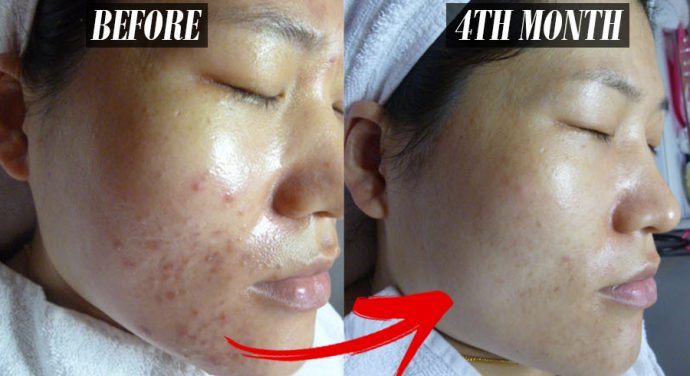 Shakura Pigmentation Facial Therapy review:brighter skin in 120 mins?