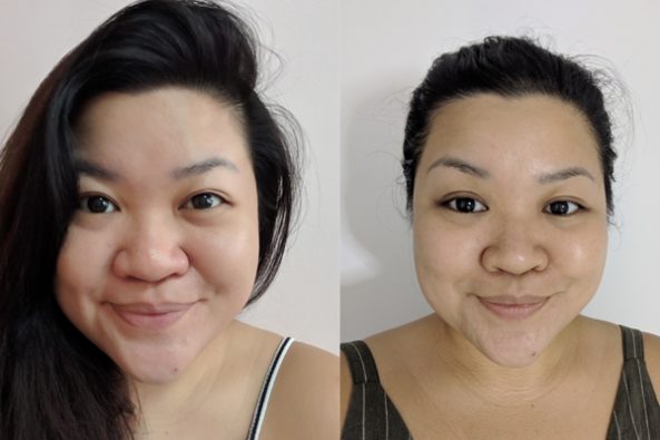 Best Sensitive Skin Facials in Singapore: Read Reviews and See What the ...