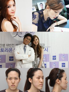 V-line face shape: We examine the different methods to achieve it and ...