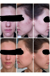 20 Most Incredible Before-and-After Photos of Redditors and Routines ...