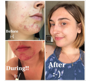 20 Most Incredible Before-and-After Photos of Redditors and Routines ...