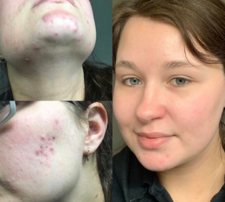 20 Most Incredible Before-and-After Photos of Redditors and Routines ...