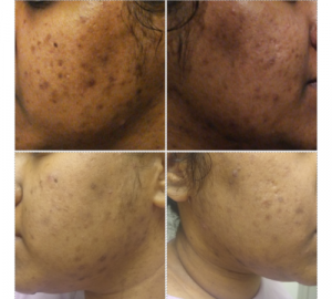 20 Most Incredible Before-and-After Photos of Redditors and Routines ...