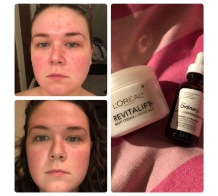 20 Most Incredible Before-and-After Photos of Redditors and Routines ...