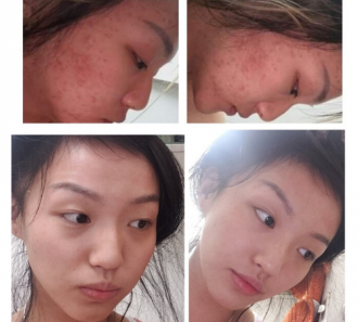 20 Most Incredible Before-and-After Photos of Redditors and Routines ...