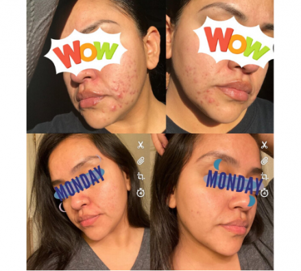 20 Most Incredible Before-and-After Photos of Redditors and Routines ...