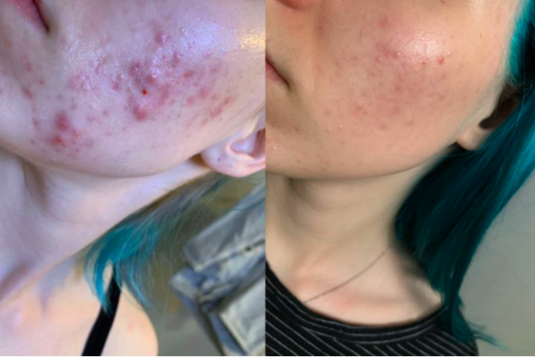 20 Most Incredible Before-and-After Photos of Redditors and Routines ...