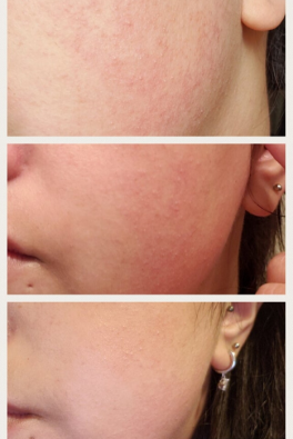 20 Most Incredible Before-and-After Photos of Redditors and Routines ...