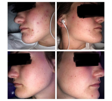 20 Most Incredible Before-and-After Photos of Redditors and Routines ...