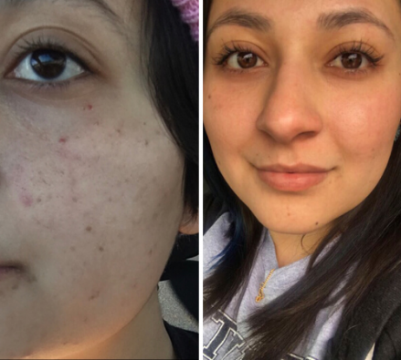 20 Most Incredible Before-and-After Photos of Redditors and Routines ...