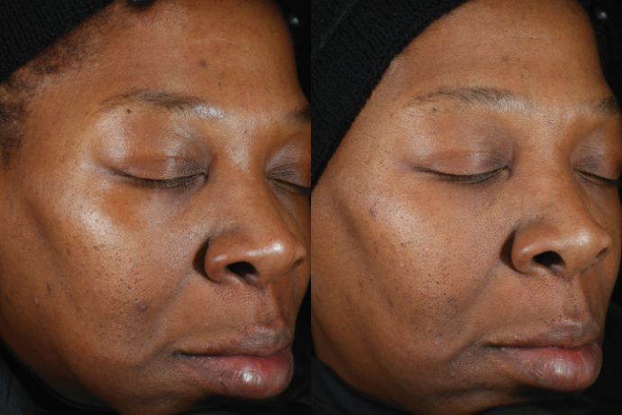 SkinCeuticals Silymarin CF is a new vitamin C serum made just for oily ...