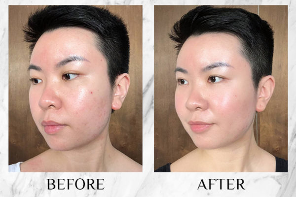 Salmon DNA is the buzzy skincare ingredient that targets multiple skin ...