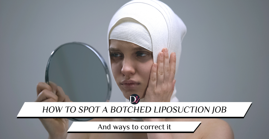 What happens when liposuction goes wrong? | Daily Vanity Singapore