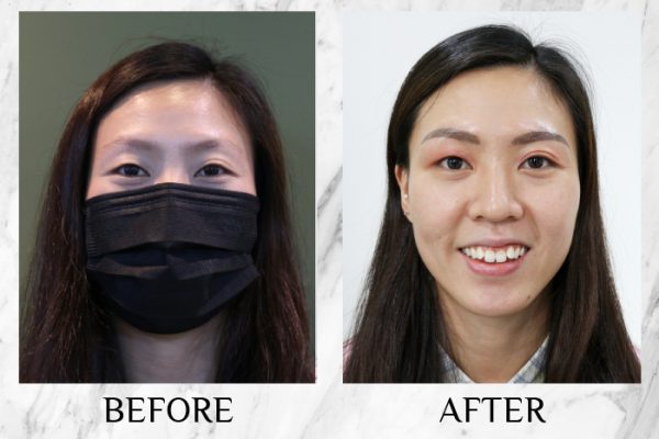 Browhaus Brow Resurrection review: Fuller-looking brows