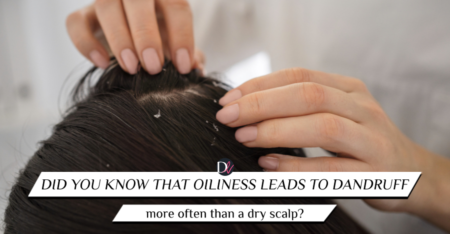 9 Best Dandruff Treatments in Singapore for a Clear Scalp