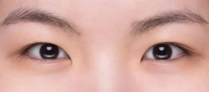 Your ultimate guide to eyelid tape, including how to wear it