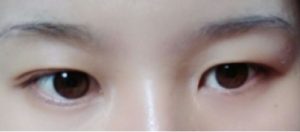 Your ultimate guide to eyelid tape, including how to wear it