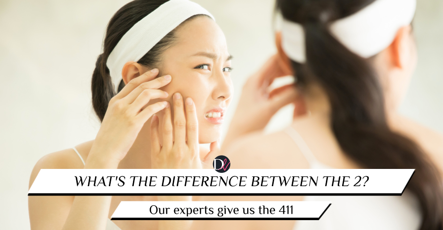 Skin Purging Vs. Breakout: How To Spot The Difference Tips – RRZC