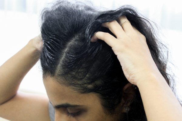 4 signs that you’re suffering from scalp inflammation – and what to do ...