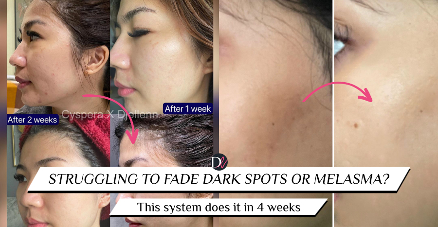 This dermatologist-recommended product lightens stubborn ...