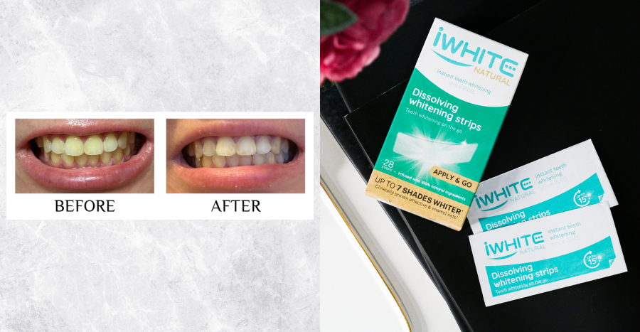 100% of our readers saw whiter teeth after 1 week of using these ...