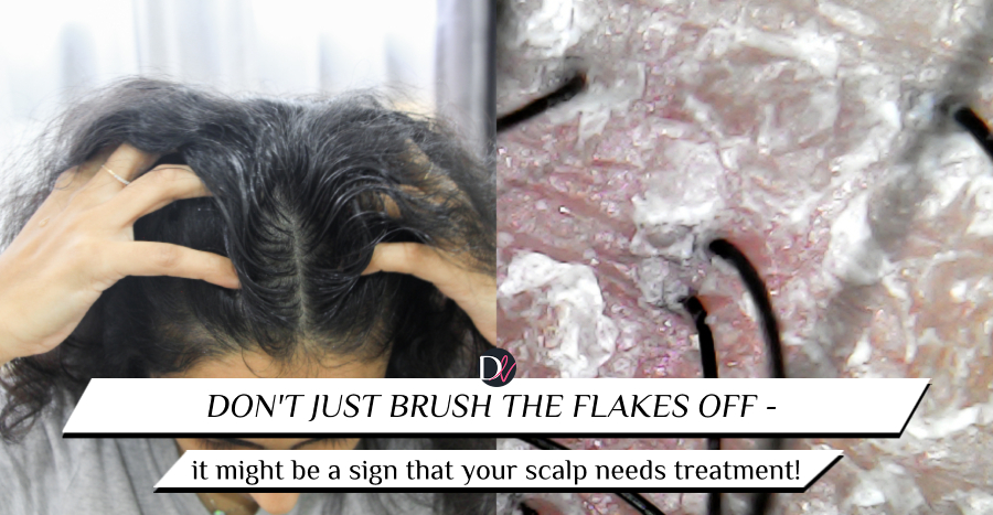 4 signs that you’re suffering from scalp inflammation – and what to do ...