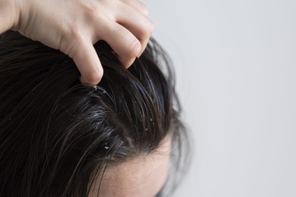 4 signs that you’re suffering from scalp inflammation – and what to do ...