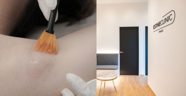 12 Best Underarm Whitening Treatments in Singapore for Brighter Armpits ...