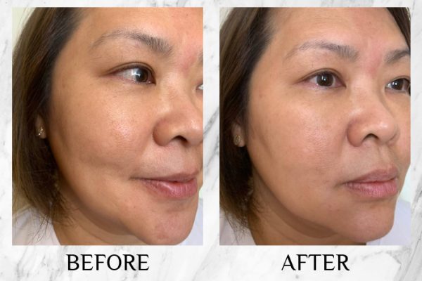 Eucerin Hyaluron-Filler + Elasticity 3D Serum review [2023]