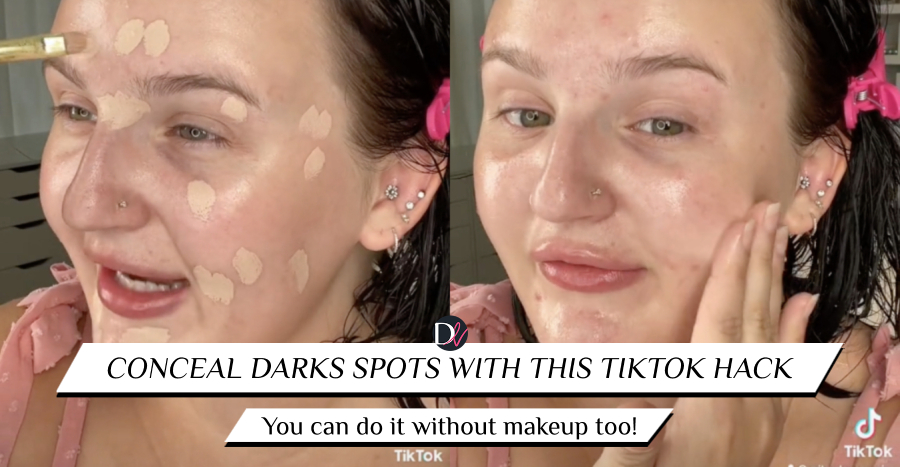 TikTok's viral "sticky method" is making dark spots just disappear ...