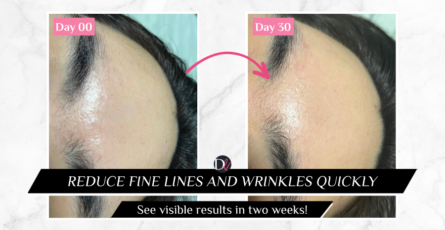 Kiehl's Retinol Fast Release Wrinkle-Reducing Night Serum Reviews