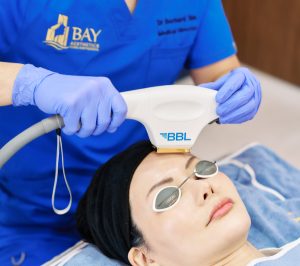 MOXI Laser: We Tried Kim Kardashian’s “Fountain of Youth”