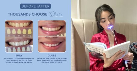 19 best teeth whitening kits to let your pearly whites shine, including ...