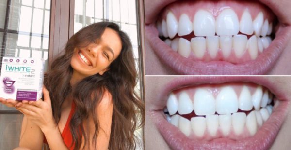 19 best teeth whitening kits to let your pearly whites shine, including ...