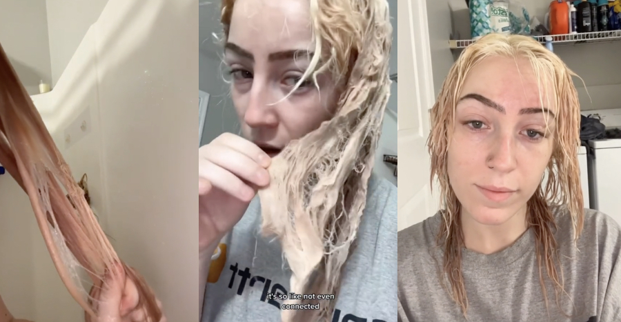 Woman loses most of her hair from DIY bleaching, breaks down ...