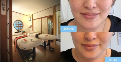 Best Facials in Singapore for Clear, Glowing Skin