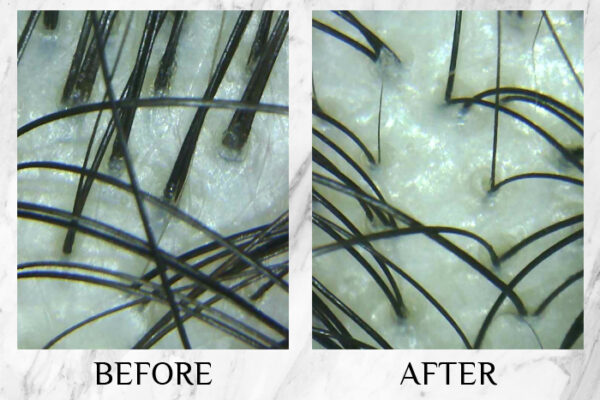 I Spent Hundreds on Oily Scalp Shampoos. Here’s One That Balances My ...