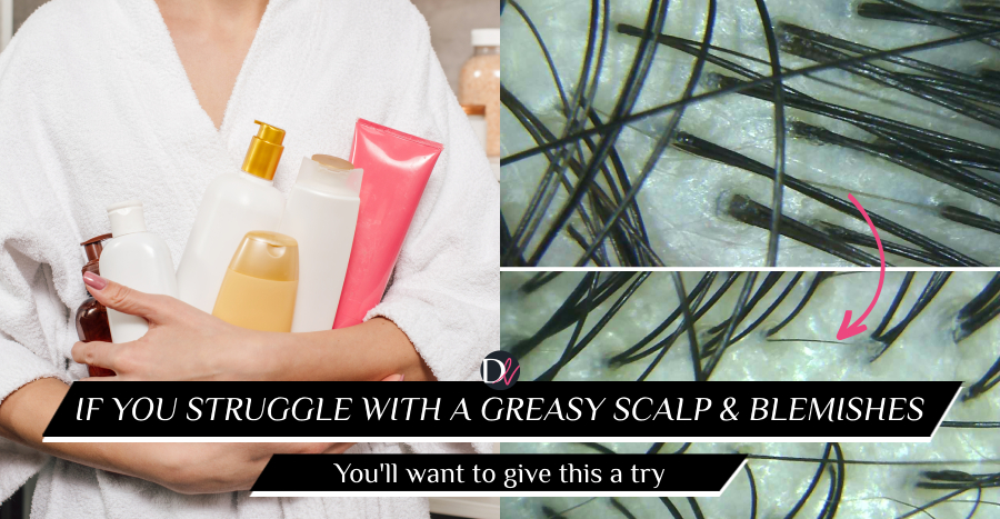 I Spent Hundreds on Oily Scalp Shampoos. Here’s One That Balances My ...