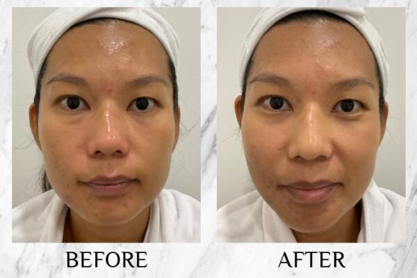 21 Aesthetics Cellular Renewal Facial reviews