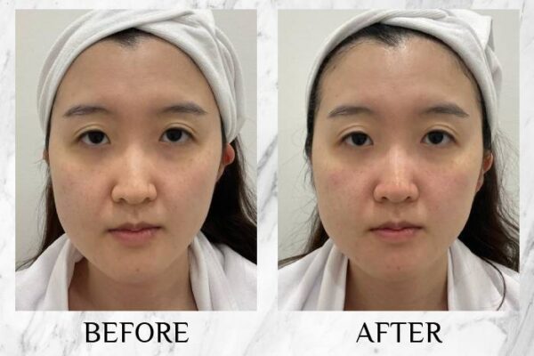 21 Aesthetics Cellular Renewal Facial reviews