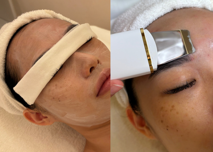 Get Glowing Skin Like Korean Celeb's Without IV Drips | Daily Vanity ...