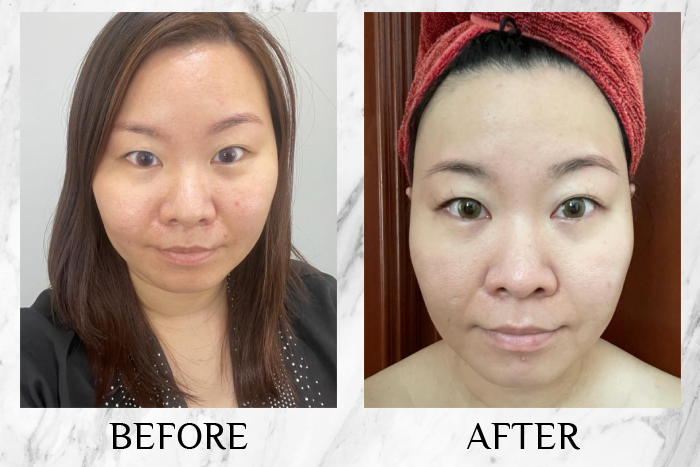 KANS Polypeptide Collagen Softening Toner and Lotion Review