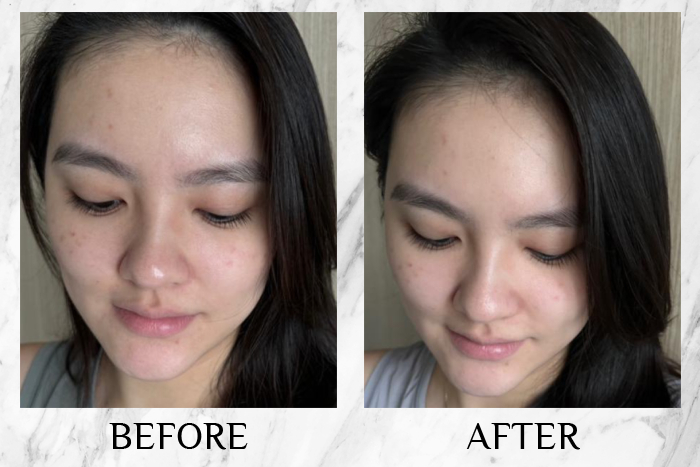 KANS Polypeptide Collagen Softening Toner and Lotion Review