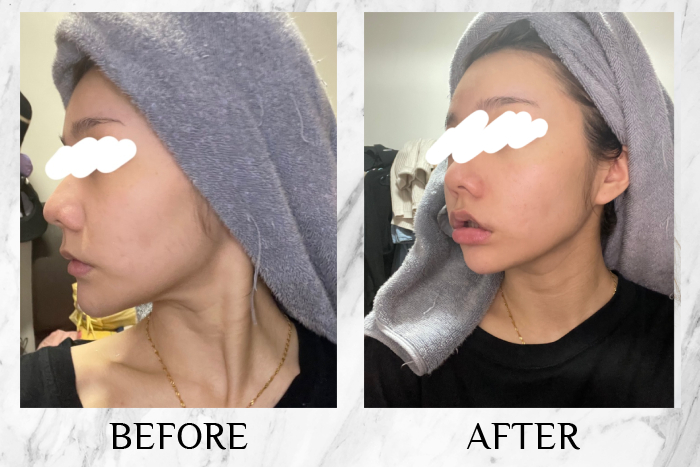 KANS Polypeptide Collagen Softening Toner and Lotion Review