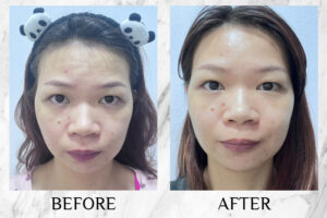 KANS Polypeptide Collagen Softening Toner and Lotion Review