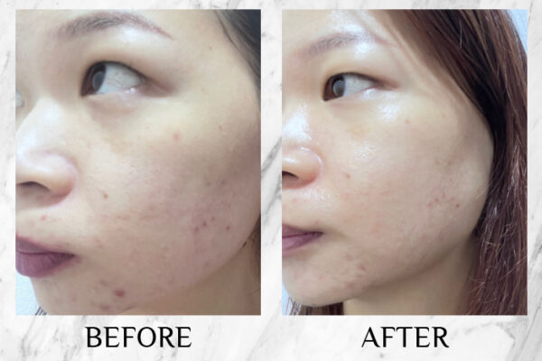 KANS Polypeptide Collagen Softening Toner and Lotion Review