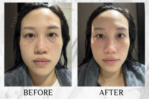 KANS Polypeptide Collagen Softening Toner and Lotion Review