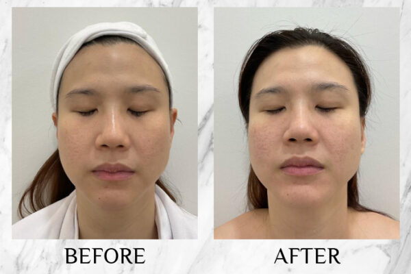 21 Aesthetics Cellular Renewal Facial reviews